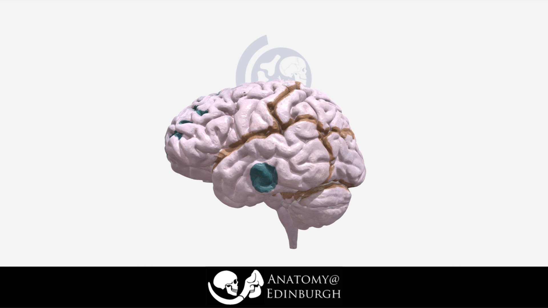 The Amygdala Hijack by Jenny Hostman - 3D model by UoEATLAS [257282c ...