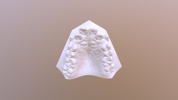 Orthodontics 3D models - Sketchfab