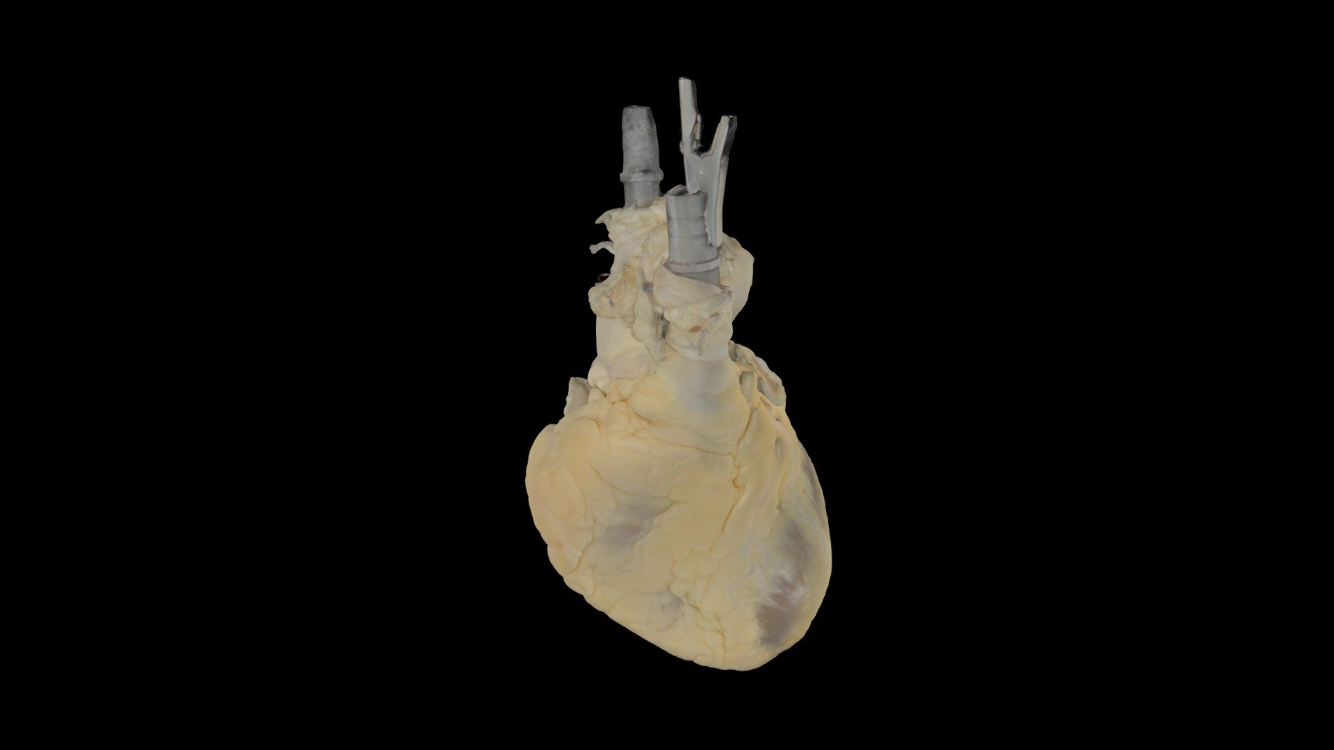 Perfusion Fixed Human Heart Donation #584 - Download Free 3D model by ...