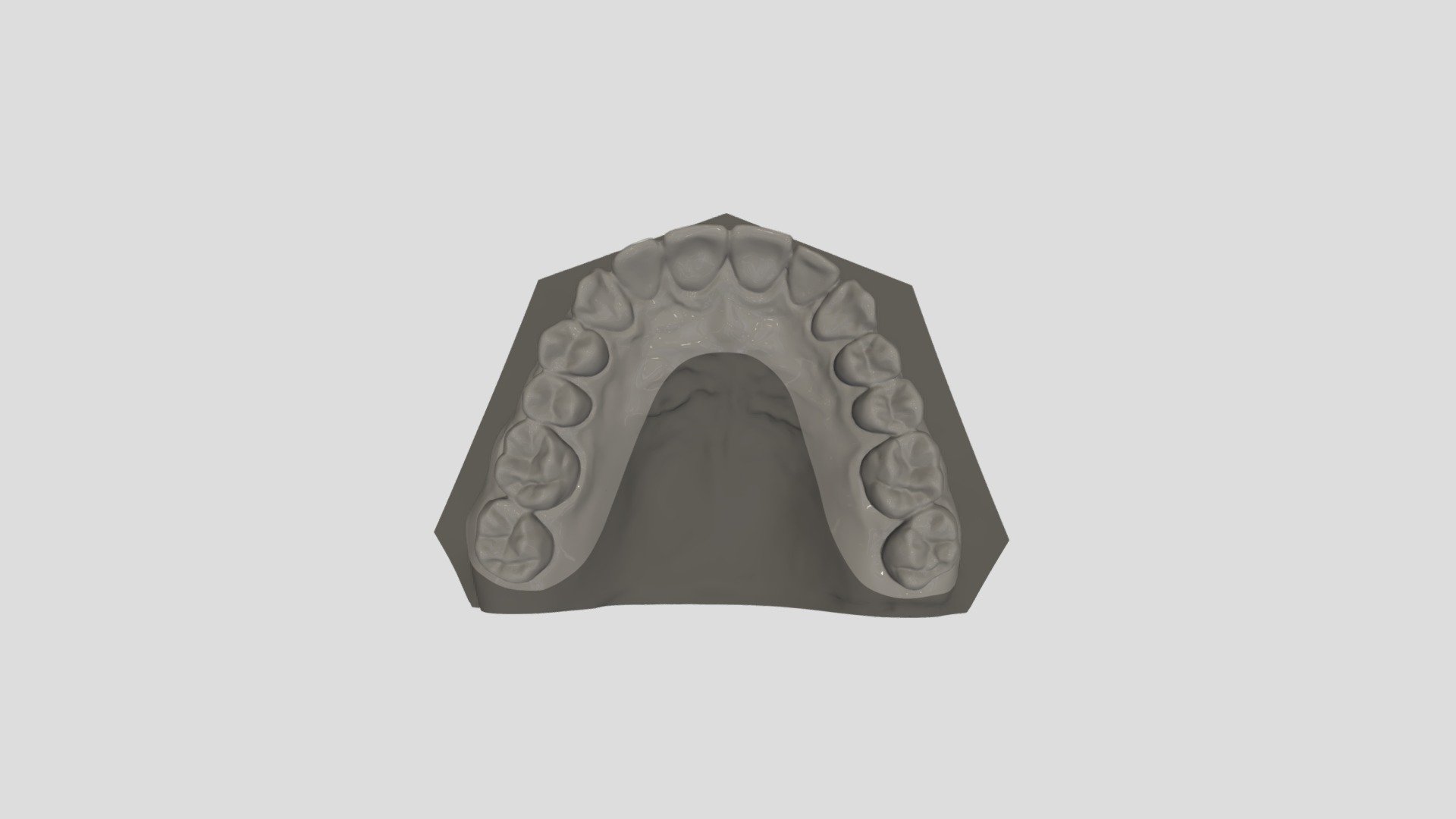 ESSIX RETAINER - 3D model by neortholab [262ebe3] - Sketchfab