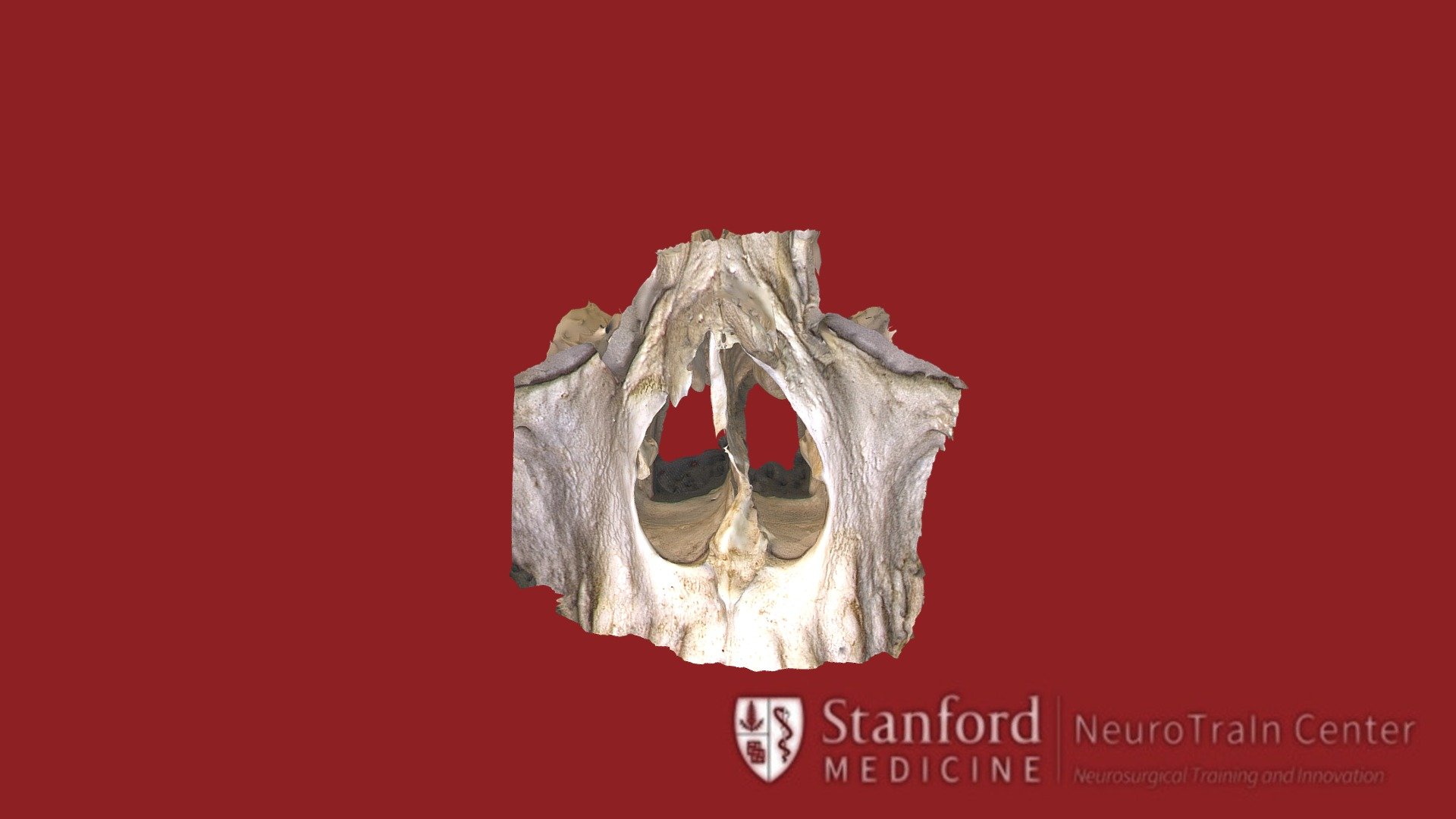 Bone anatomy of the nose - 3D model by vv (@verav) [26ce683] - Sketchfab