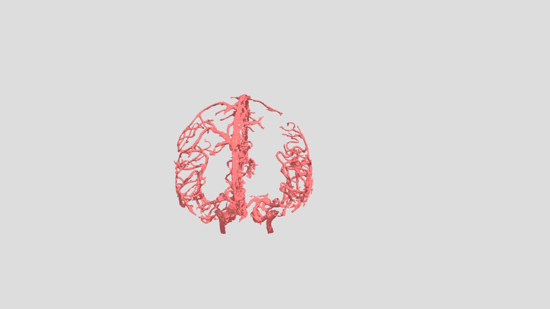 Complex ACom Aneurysm - 3D model by Dr. Samuel Damin (@sdamin) [270316d ...