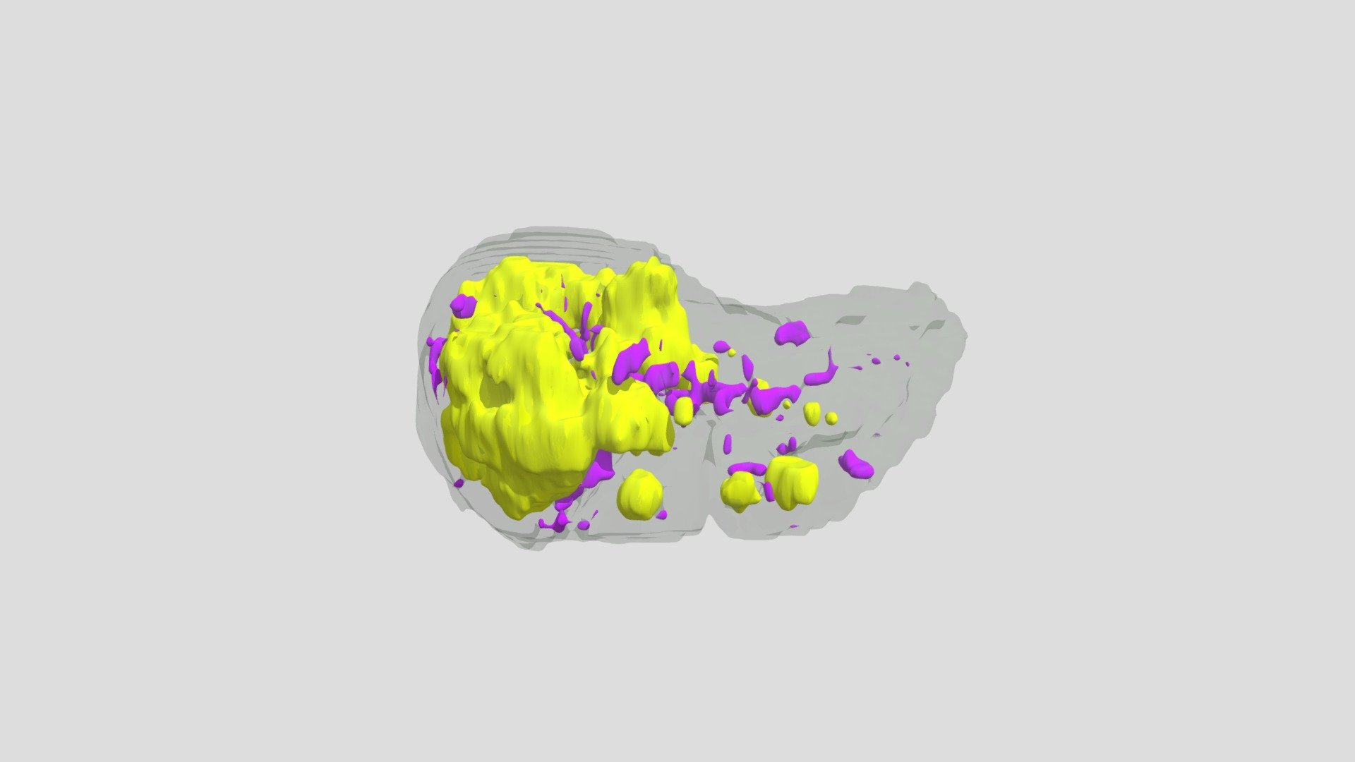 253200703240401.nii.gz - 3D model by Keyur Radiya (@keyurradia ...