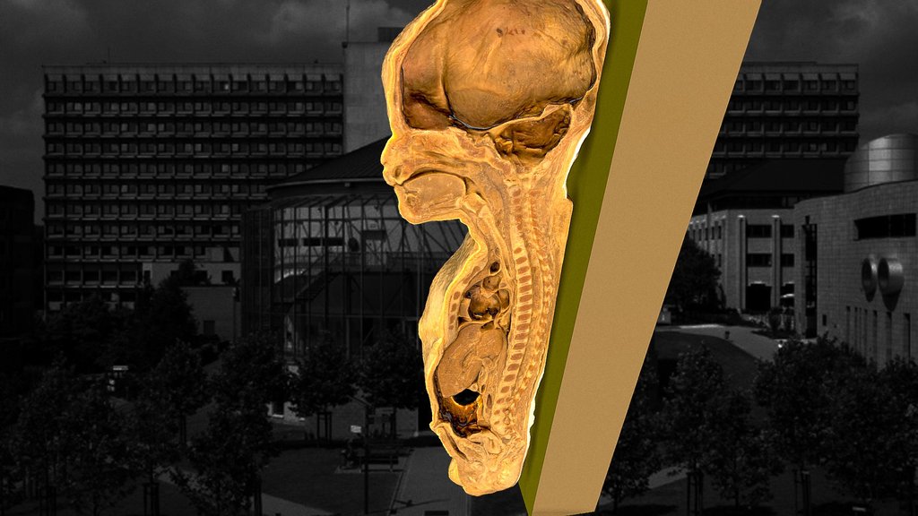 Dissection - A 3D model collection by Prof. Serge VAN SINT JAN - Univ ...