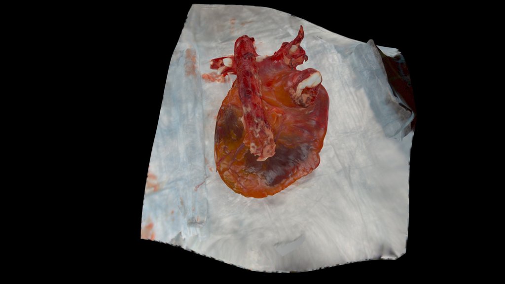 Cadaver Dissection Heart0629 - A 3D model collection by ...