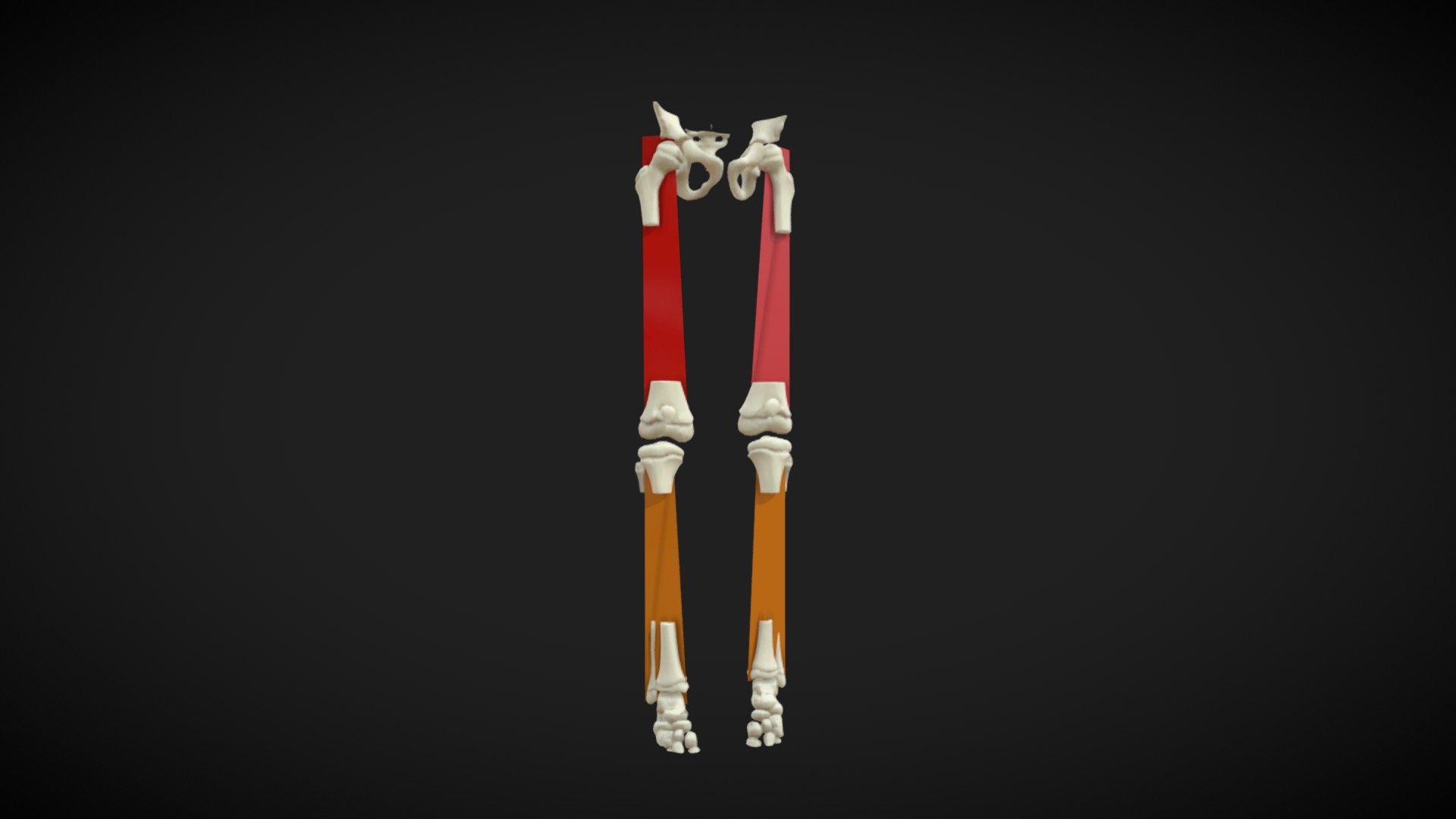 Lower Extremity Torsion - 3D model by Lincoln Wong (@lincolnwong ...