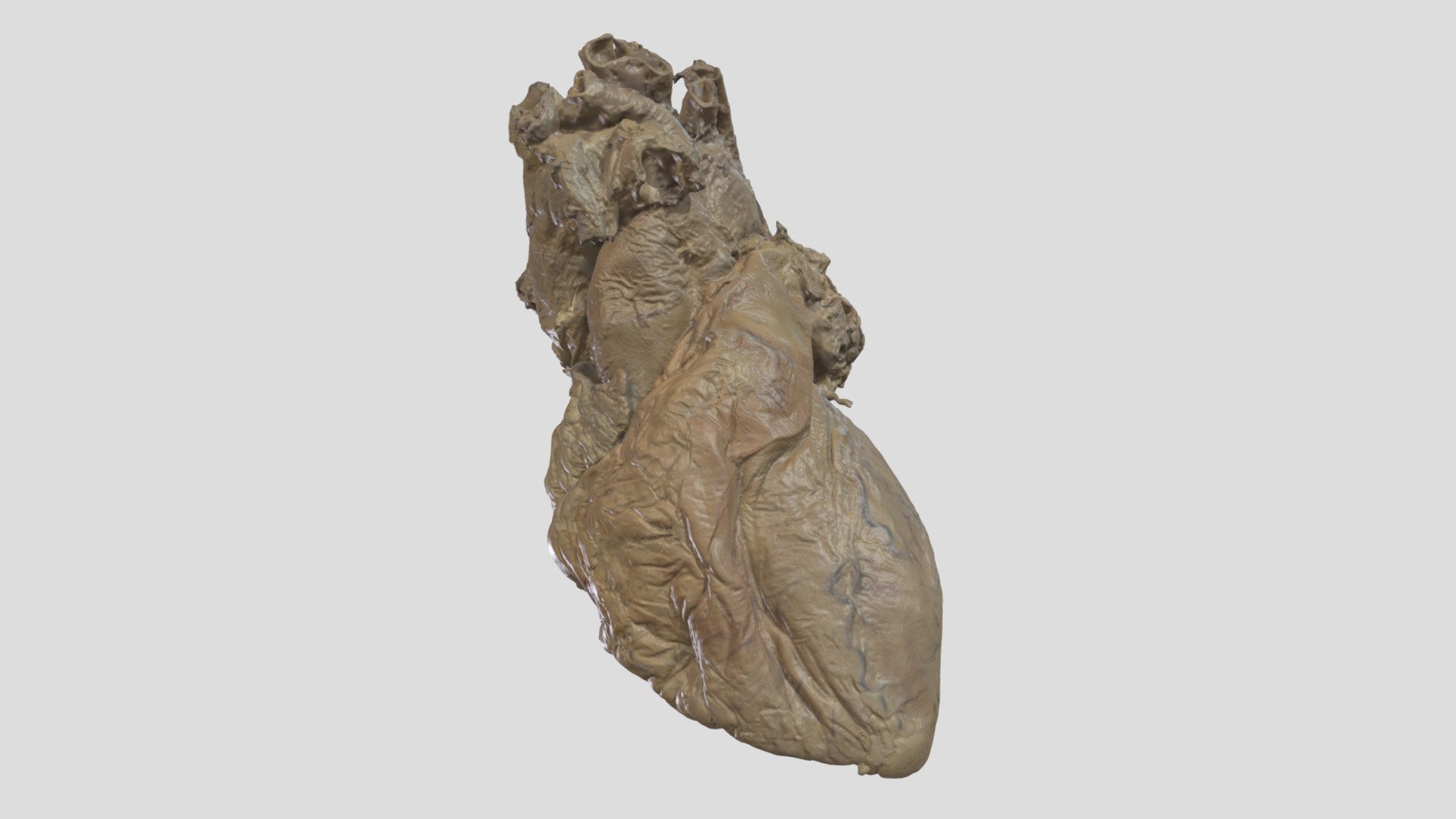 Whole Heart - Download Free 3D model by CU Modern Human Anatomy Program ...