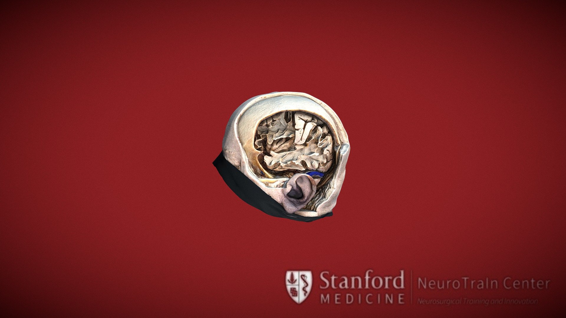 Arcuate Fasciculus - 3D model by vv (@verav) [29bc834] - Sketchfab