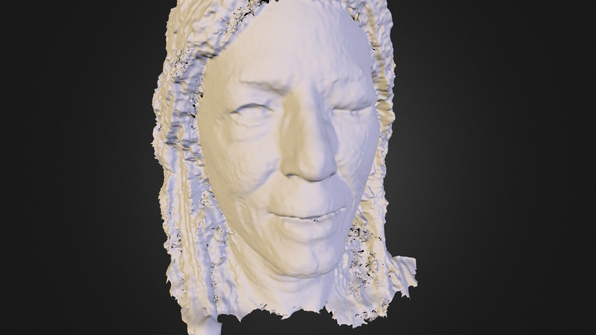 Eyelid recon - 3D model by orenteppermd [29c3301] - Sketchfab