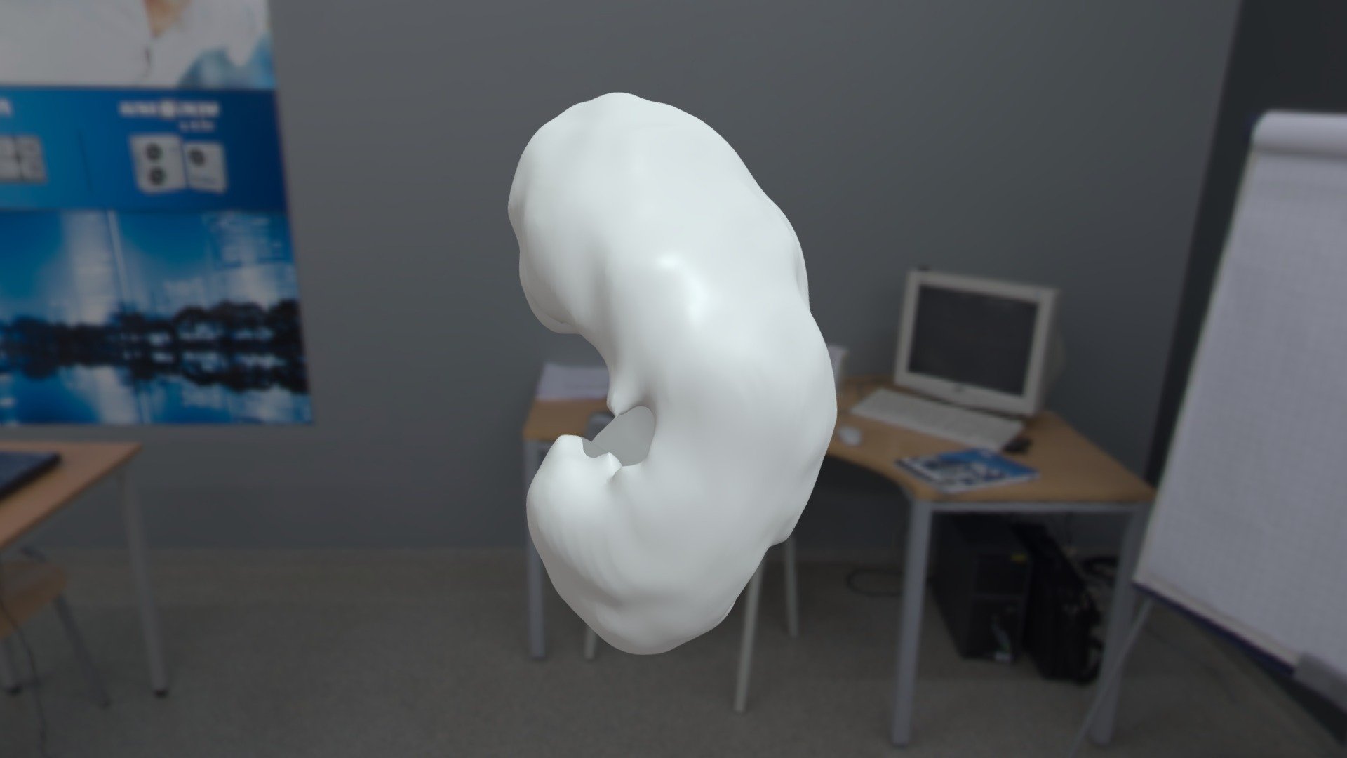 Segmentation_ Left Kidney - 3D model by DXLand [29dfdcd] - Sketchfab