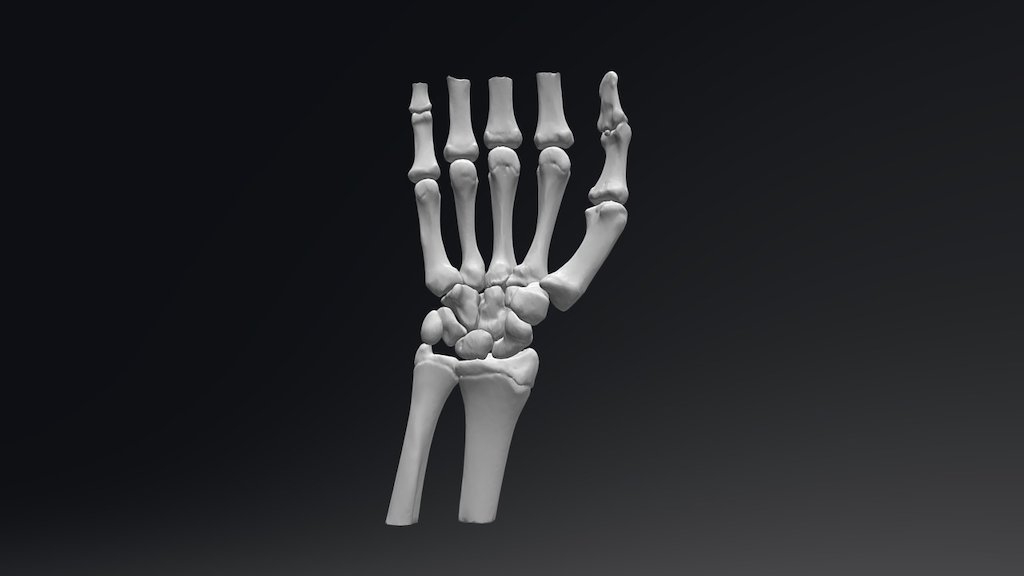 Full Hand - 3D model by Clínica 3D (@clinica3d) [2a1f30a] - Sketchfab