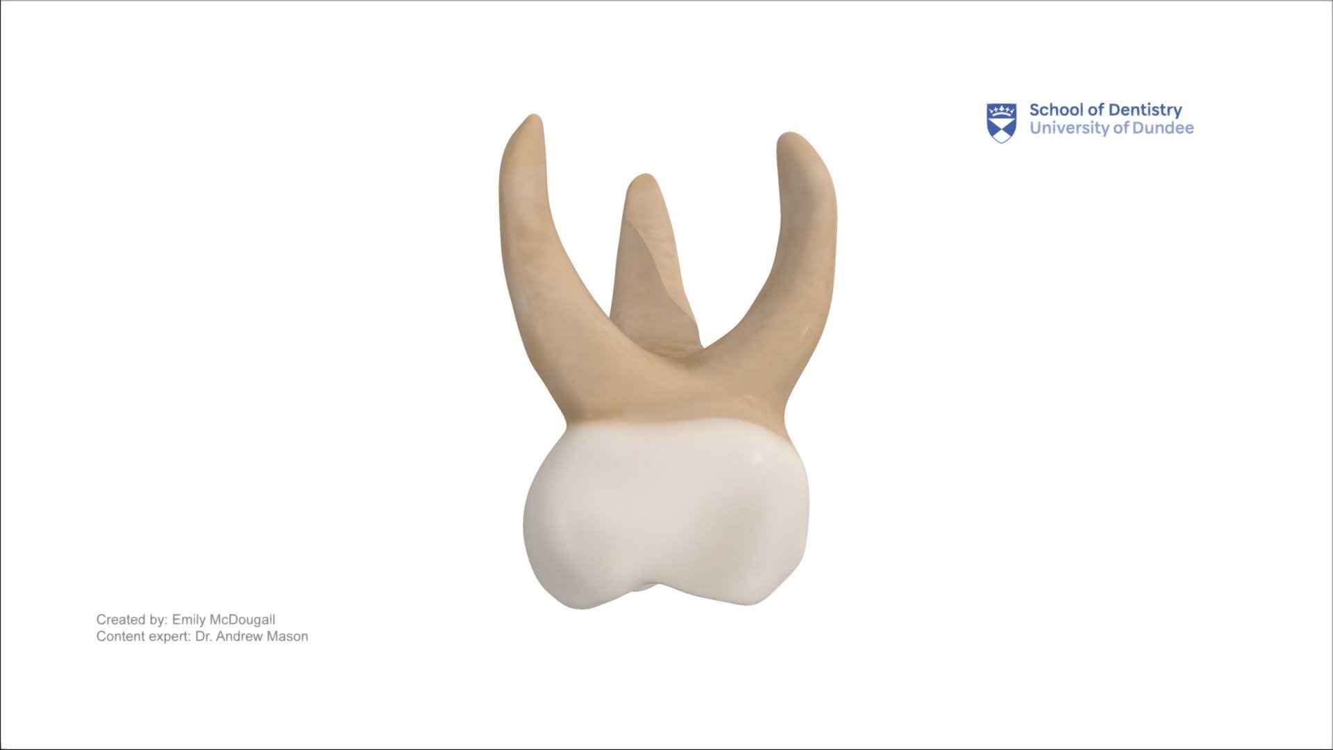 Primary upper left second molar (FDI 65) - Download Free 3D model by ...