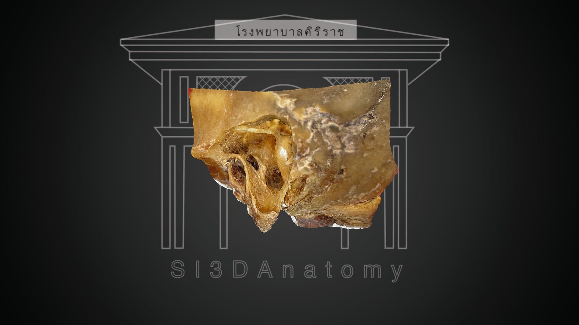 Ear Anatomy (Mastoidectomy) - 3D model by SI3DAnatomy [2a21fe5] - Sketchfab