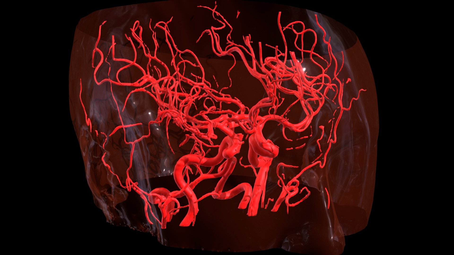 Arterias Cerebrales: MRI TOF (Time of Flight). - 3D model by quequen ...