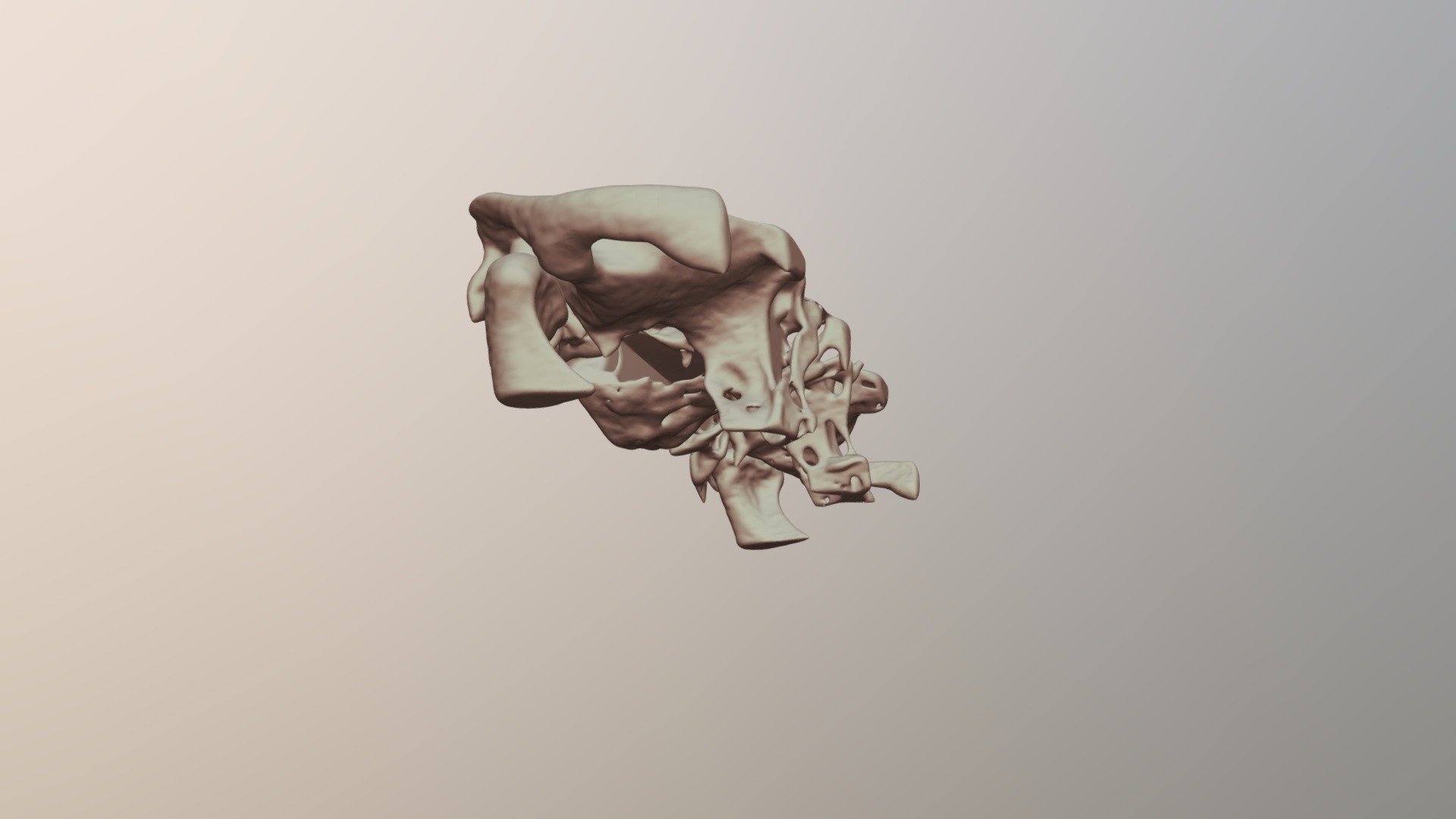 Anatomic TMJ ATM Joint - 3D model by 3Dsurgery [2a517da] - Sketchfab