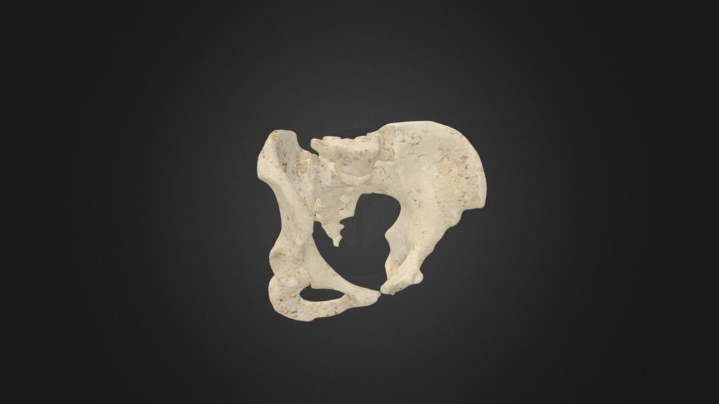 HumanX - Open-book-fracture - 3D model by HumanX Medical Simulators ...