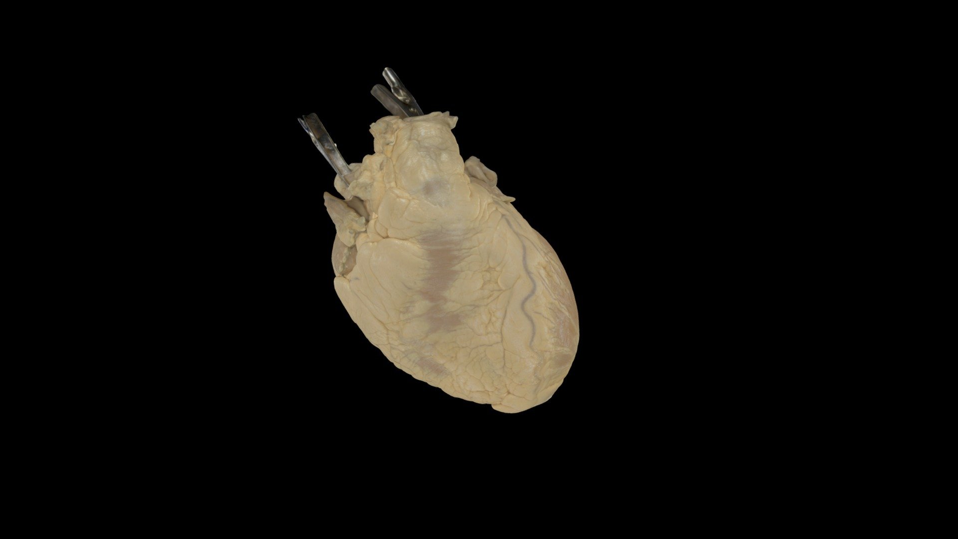 Heart Donation #69 - Download Free 3D model by VisibleHeartLabs ...