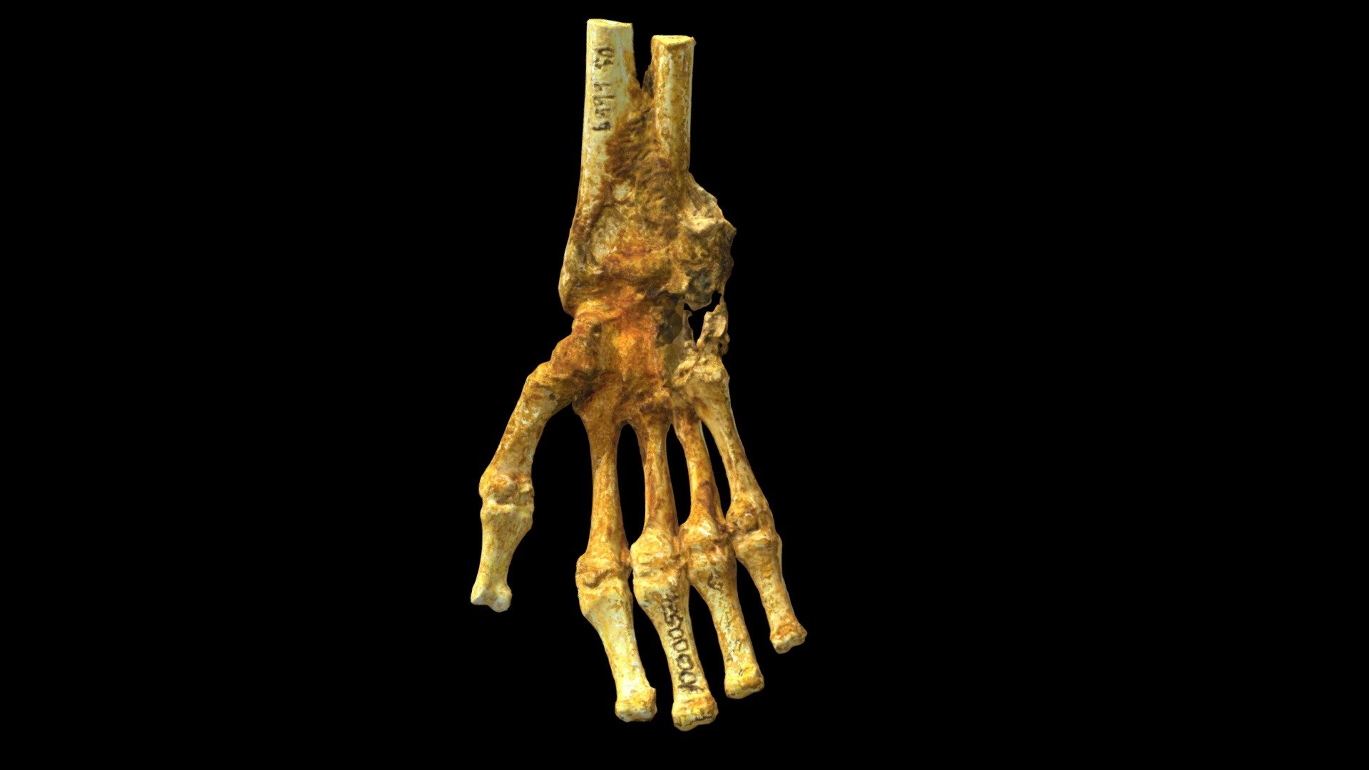 R Hand and Wrist w GSW (VCU_3D_3969) - 3D model by Virtual Curation Lab ...