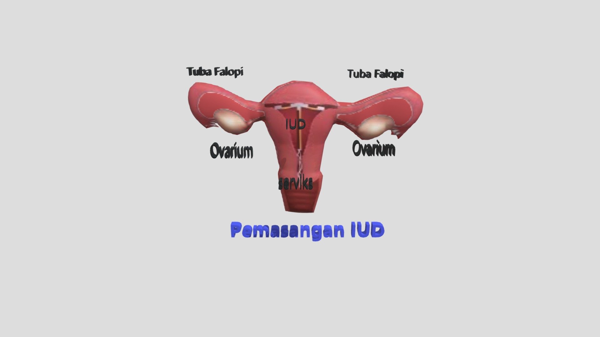 IUD - Download Free 3D model by widyawiwied21 [2a86292] - Sketchfab