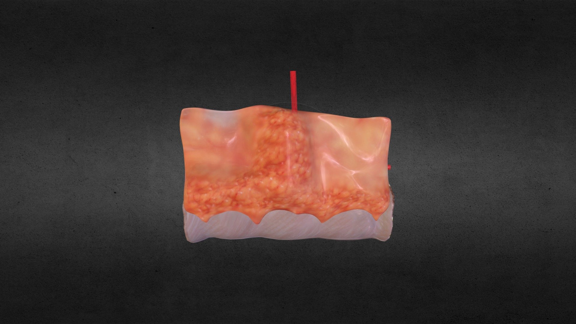 fat Wrapping Medium - 3D model by Dara Walsh (@darawalsh) [2a961b9 ...