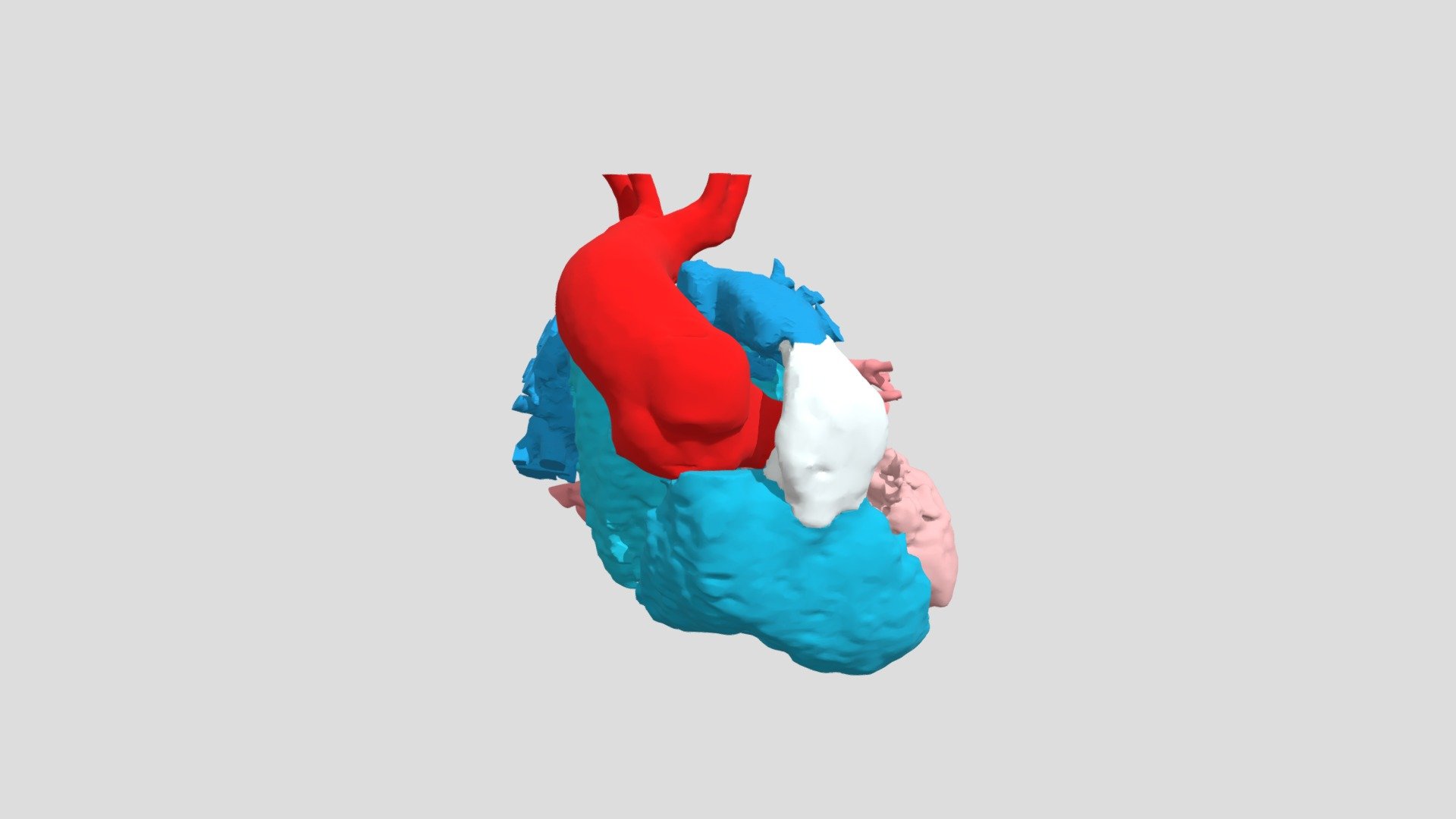D-TGA, LPA Stent (S0408) - 3D model by NCH Advanced Projects Laboratory ...