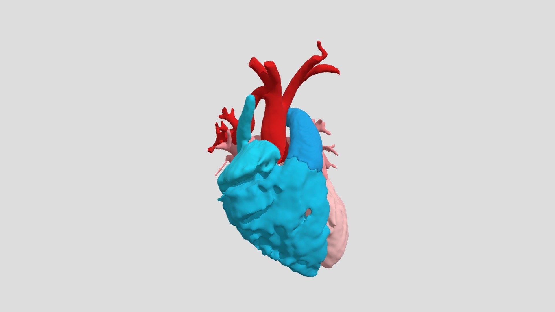 Bilateral PDA, Anomalous Origin of RPA (S0392) - 3D model by NCHS ...
