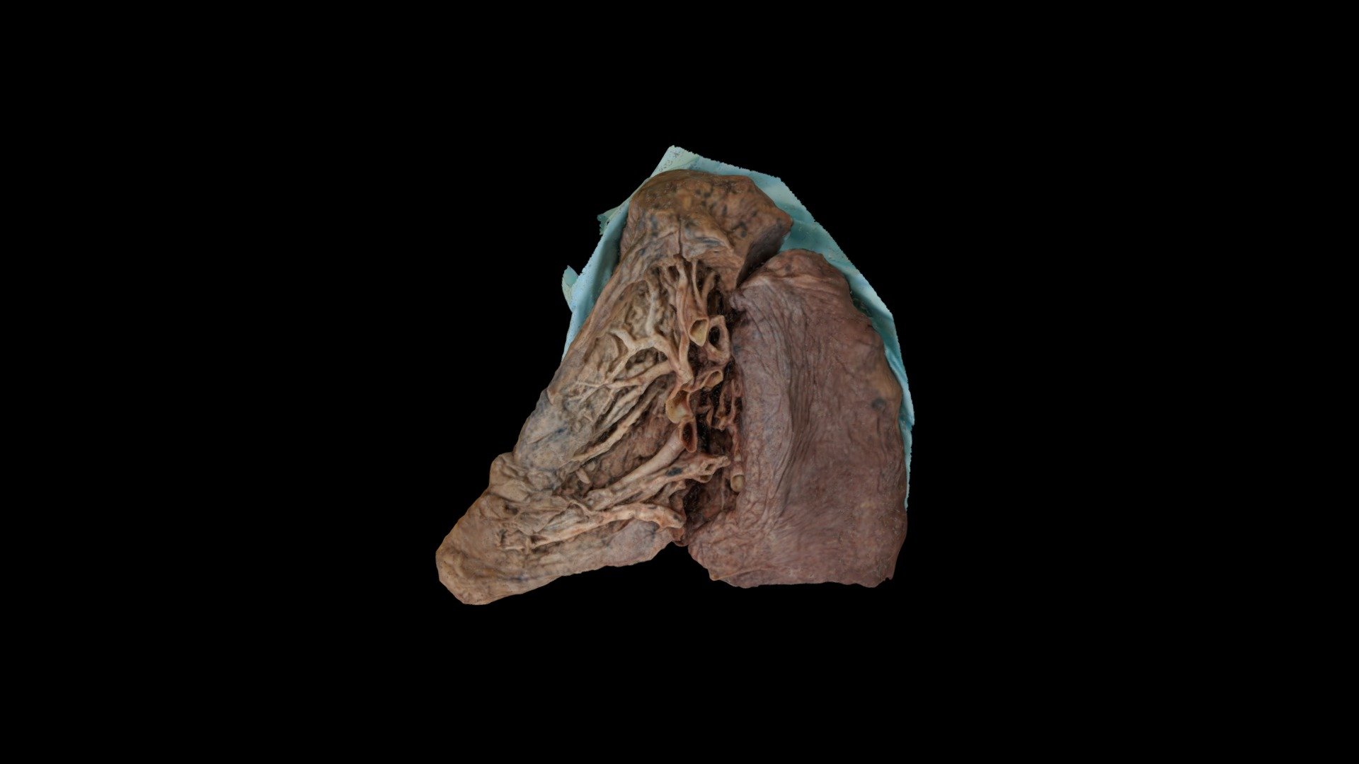 Lung 3d Model By Shaun Shaunkim94 [2b22c48] Sketchfab