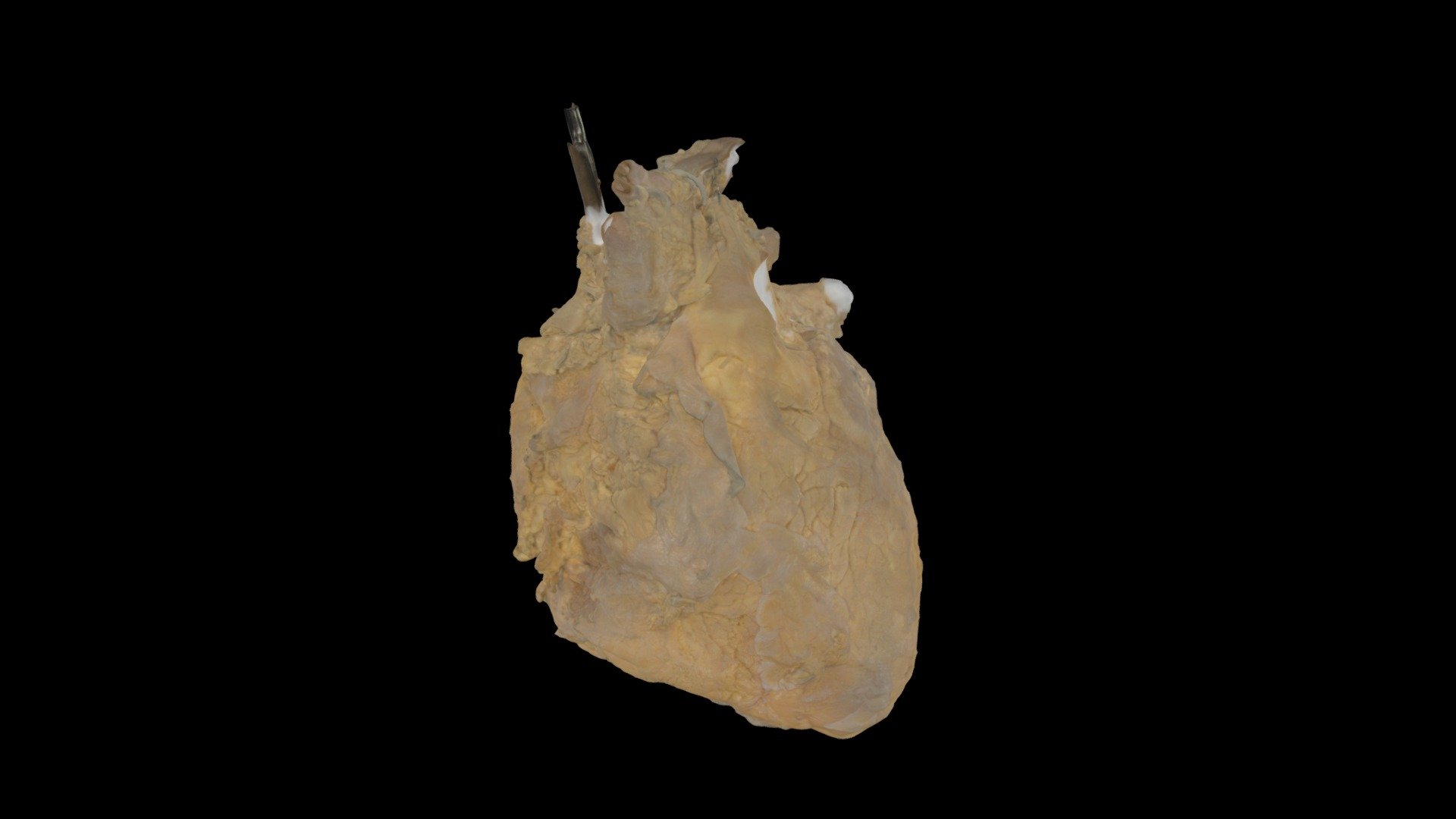 Fixed Human Heart with Bypass Graft - Download Free 3D model by ...