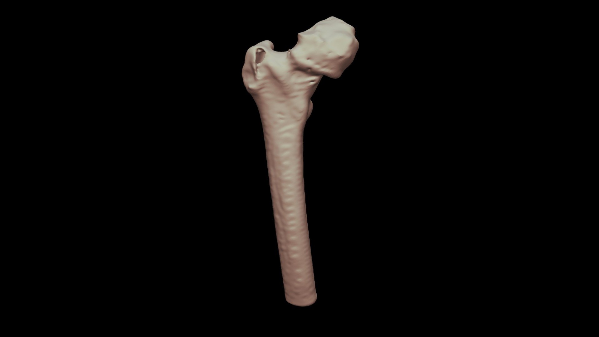 Segmentation_femur rt - 3D model by Medimax Advance Radio-Imaging ...