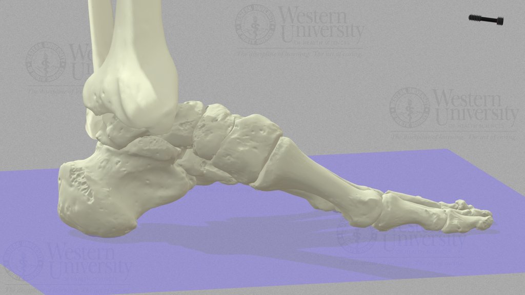 Podiatric Biomechanics - 3D Models and Animations - A 3D model ...