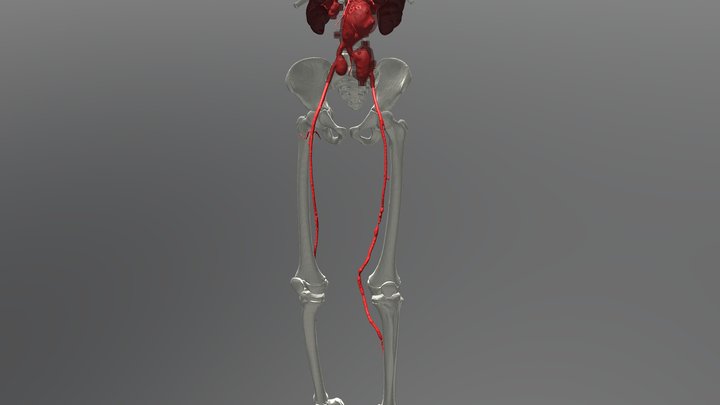 Aorta 3D models - Sketchfab