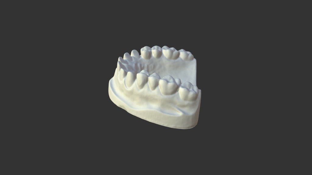 Dental model scanned with EinScan-S - 3D model by MakerTree 3D (@cam ...