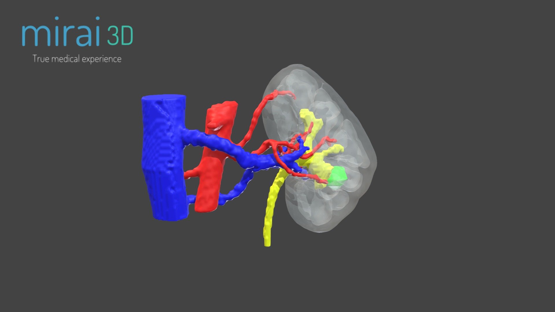 Medical Model WP70 - Urology - 3D model by MIRAI3D [2d11070] - Sketchfab