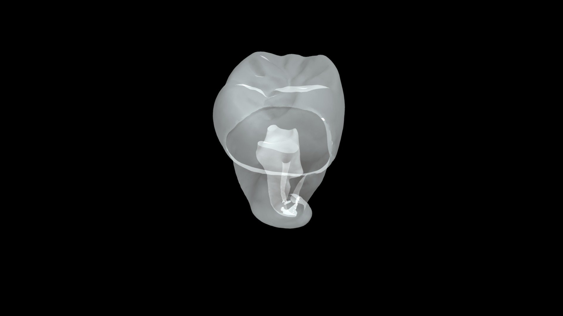 3rd molar curved hard - 3D model by biomed3d [2d255be] - Sketchfab