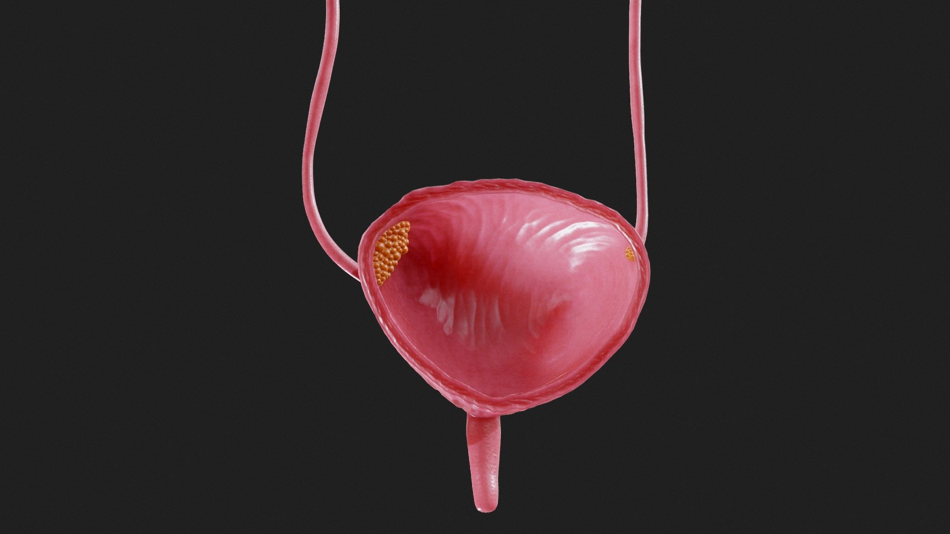 Bladder Cancer Anatomy - Buy Royalty Free 3D model by Nima (@h3ydari96 ...