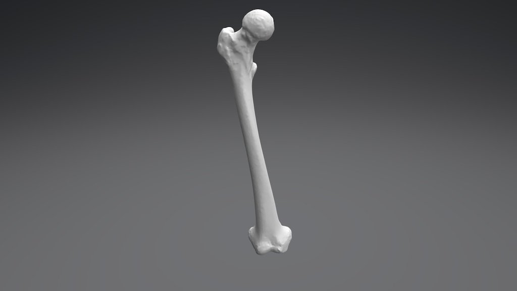 Right Femur - 3D model by Clínica 3D (@clinica3d) [2ddc227] - Sketchfab