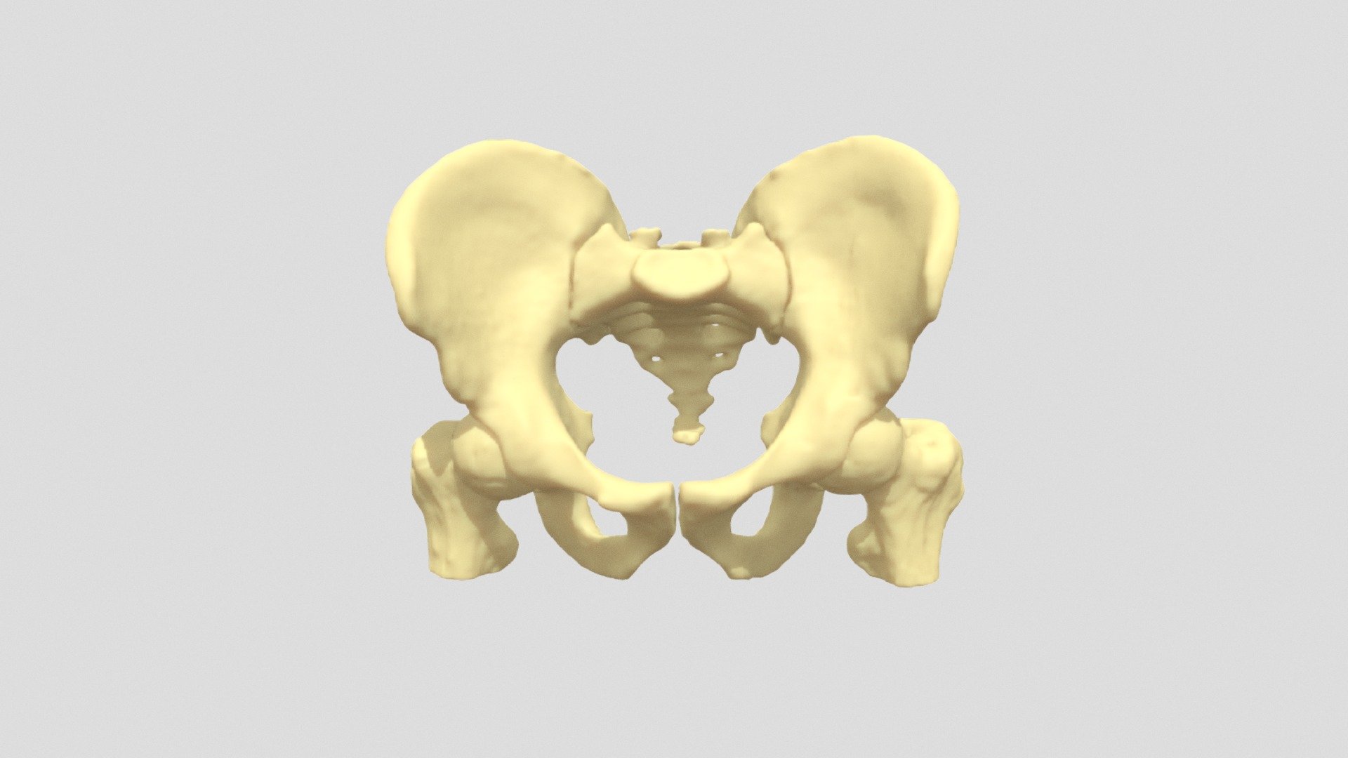 Cadera con Deformidad - Download Free 3D model by Biomedic-Lab3D ...