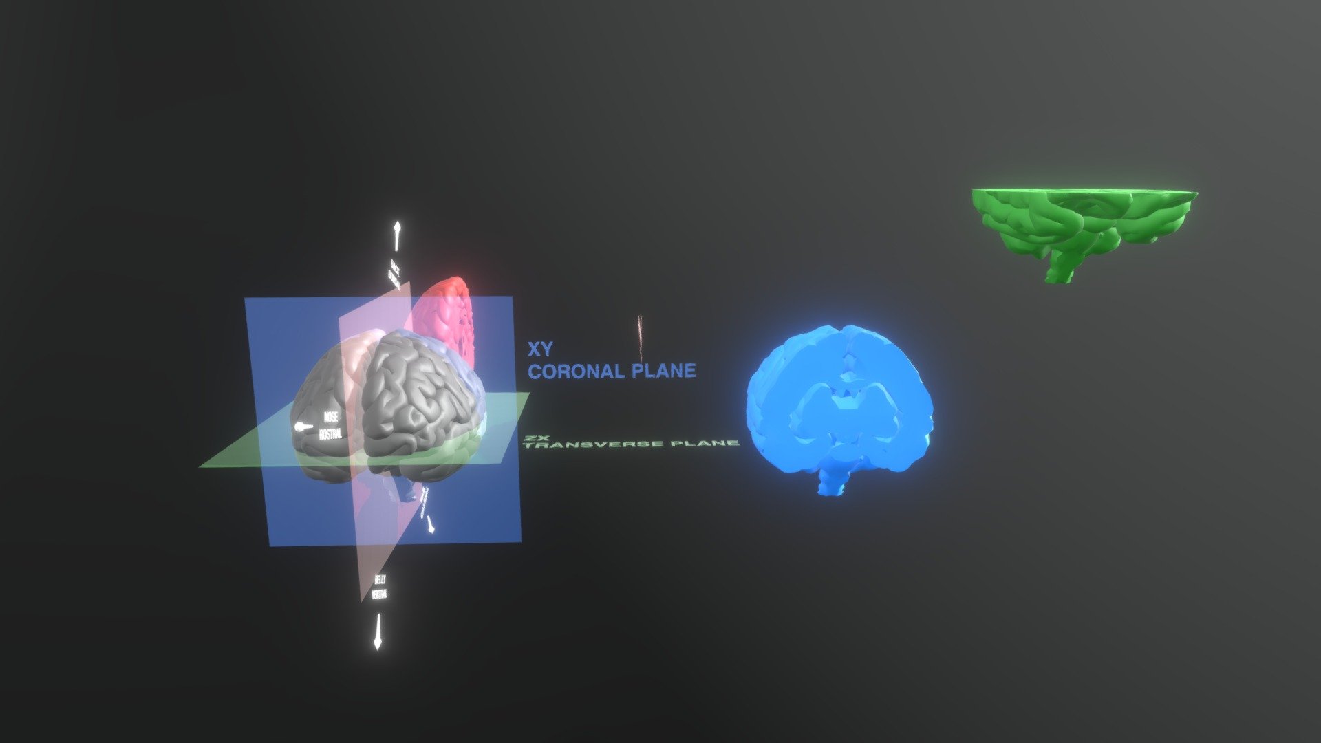 Brain Orientation - 3D model by vanyang [2e78e15] - Sketchfab