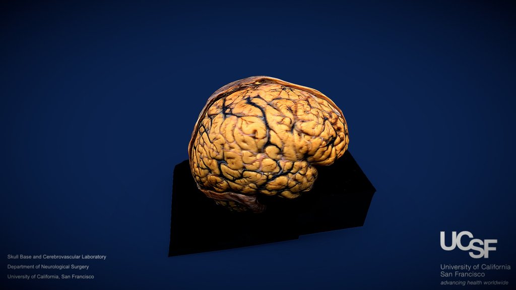 Construction of Neuroanatomical Volumetric Models - A 3D model ...