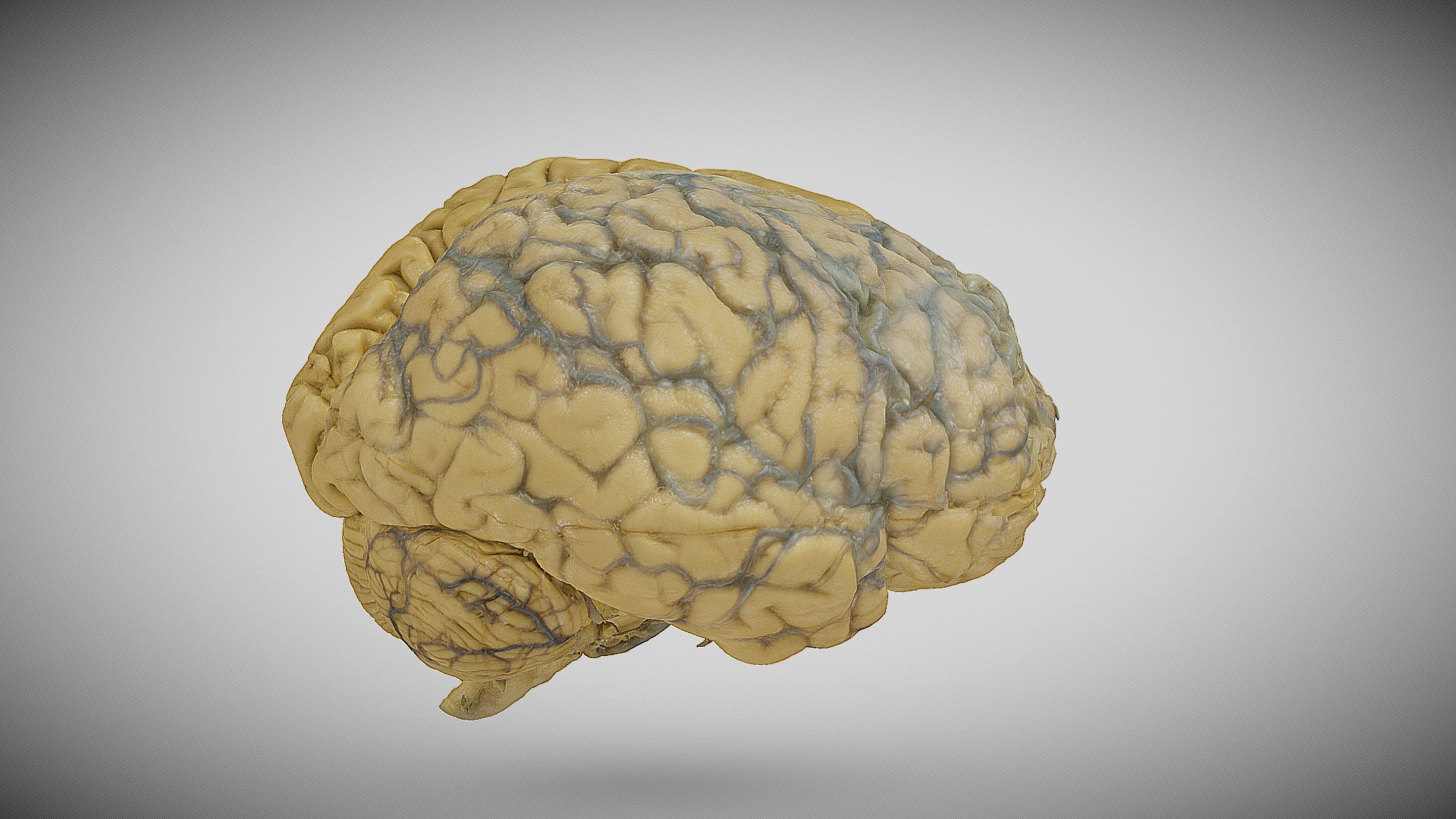Human Brain, plastinated (high res) - 3D model by Vida_Lab [3000454 ...