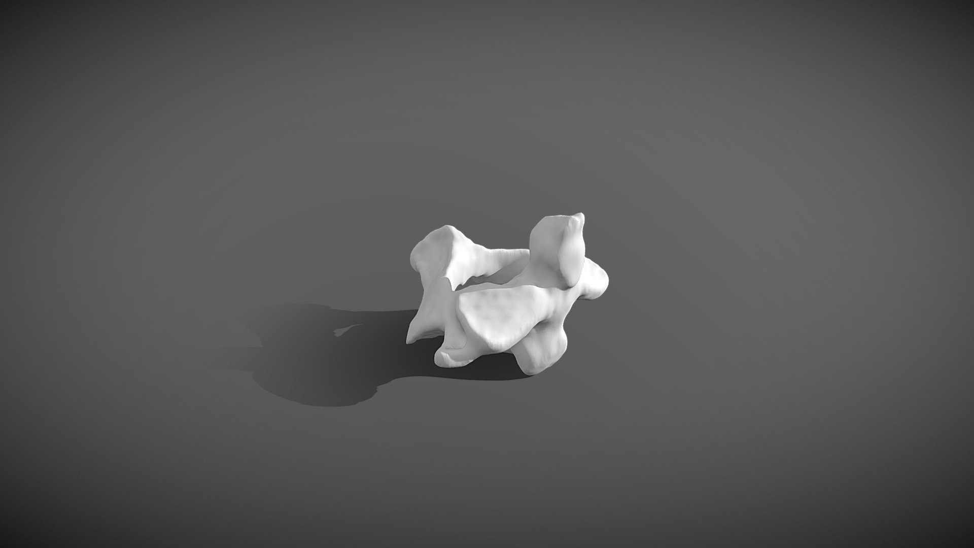 Axis - C2 vertebra - 3D model by ersinalishev [300881d] - Sketchfab