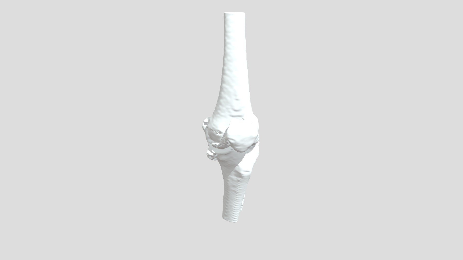 Segmentation Kan Dob Lt Bone - 3D model by curisdata.science [30225d1 ...