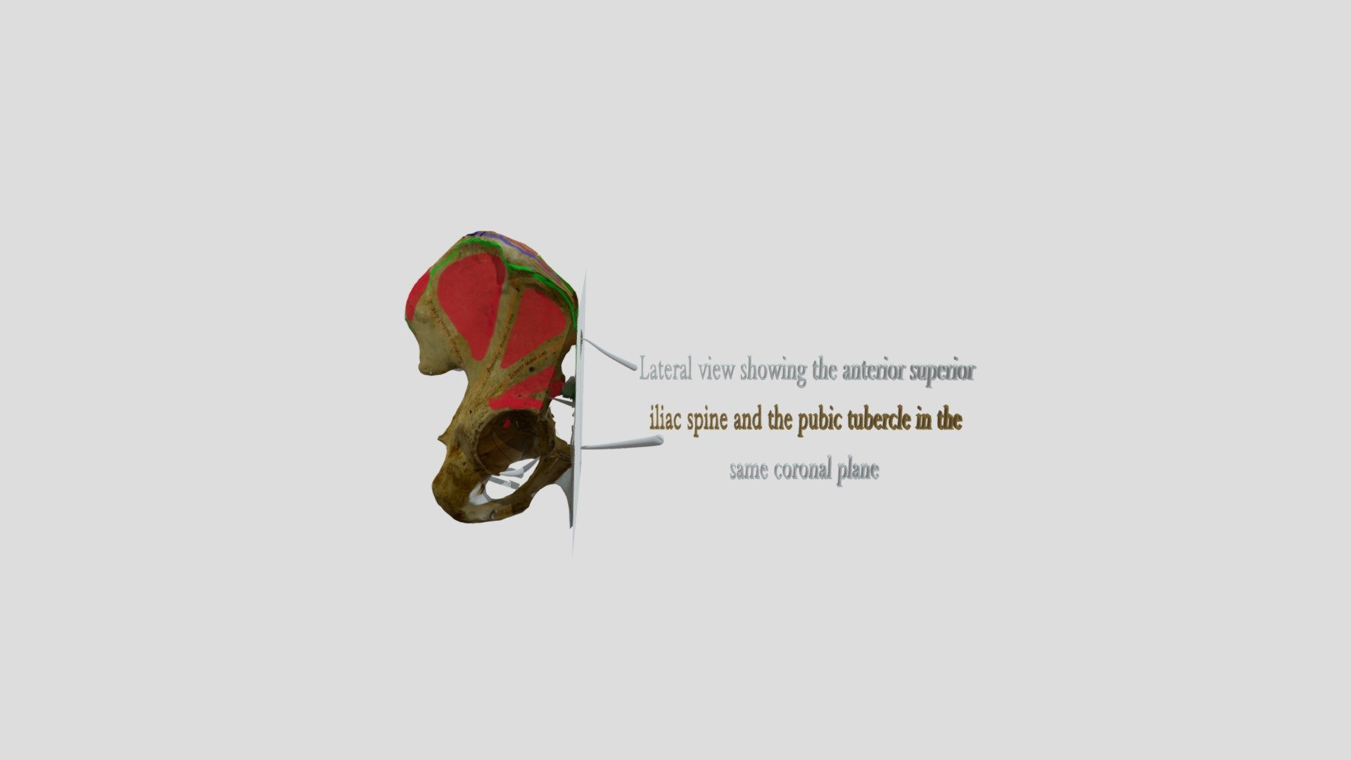 Iliac Crest - 3D model by prajjawalit [304462b] - Sketchfab