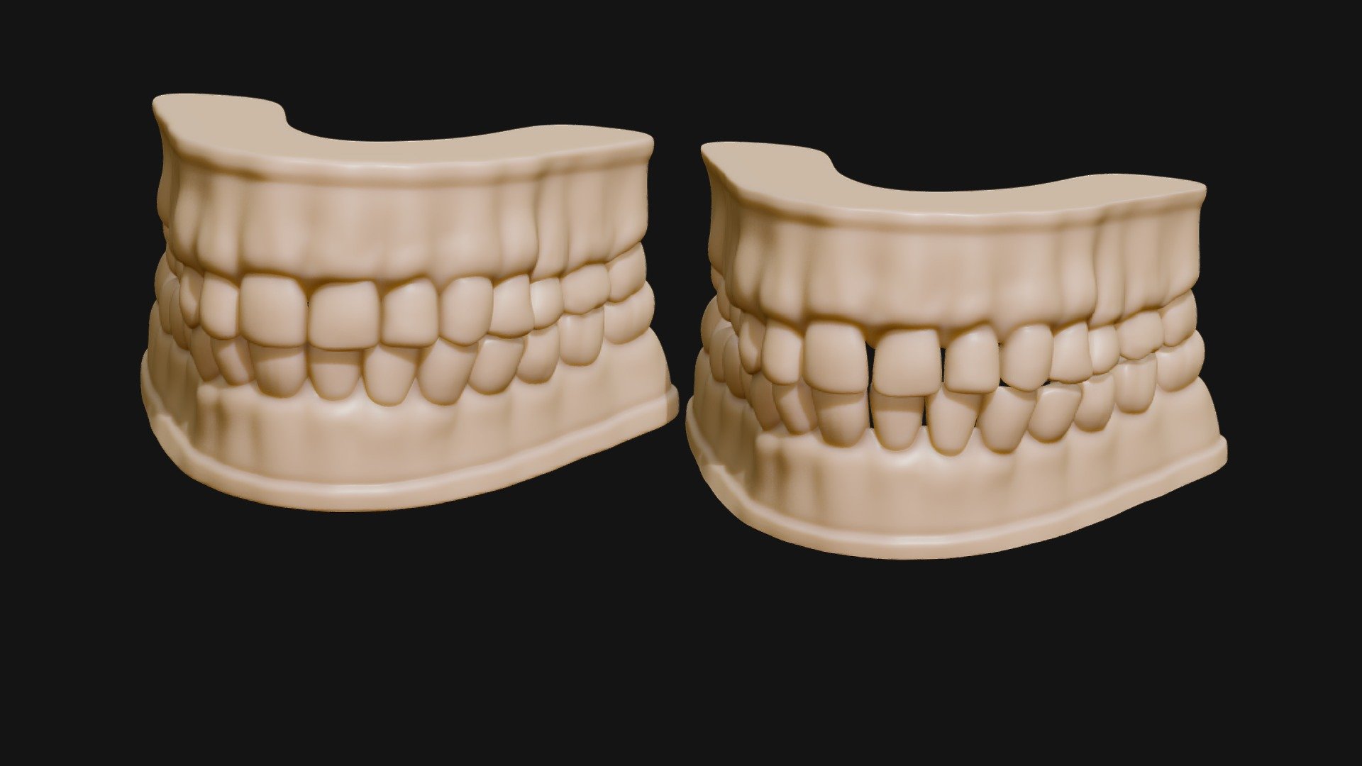 Dentures Mold - Buy Royalty Free 3D model by zames1992 [3053663] - Sketchfab Store