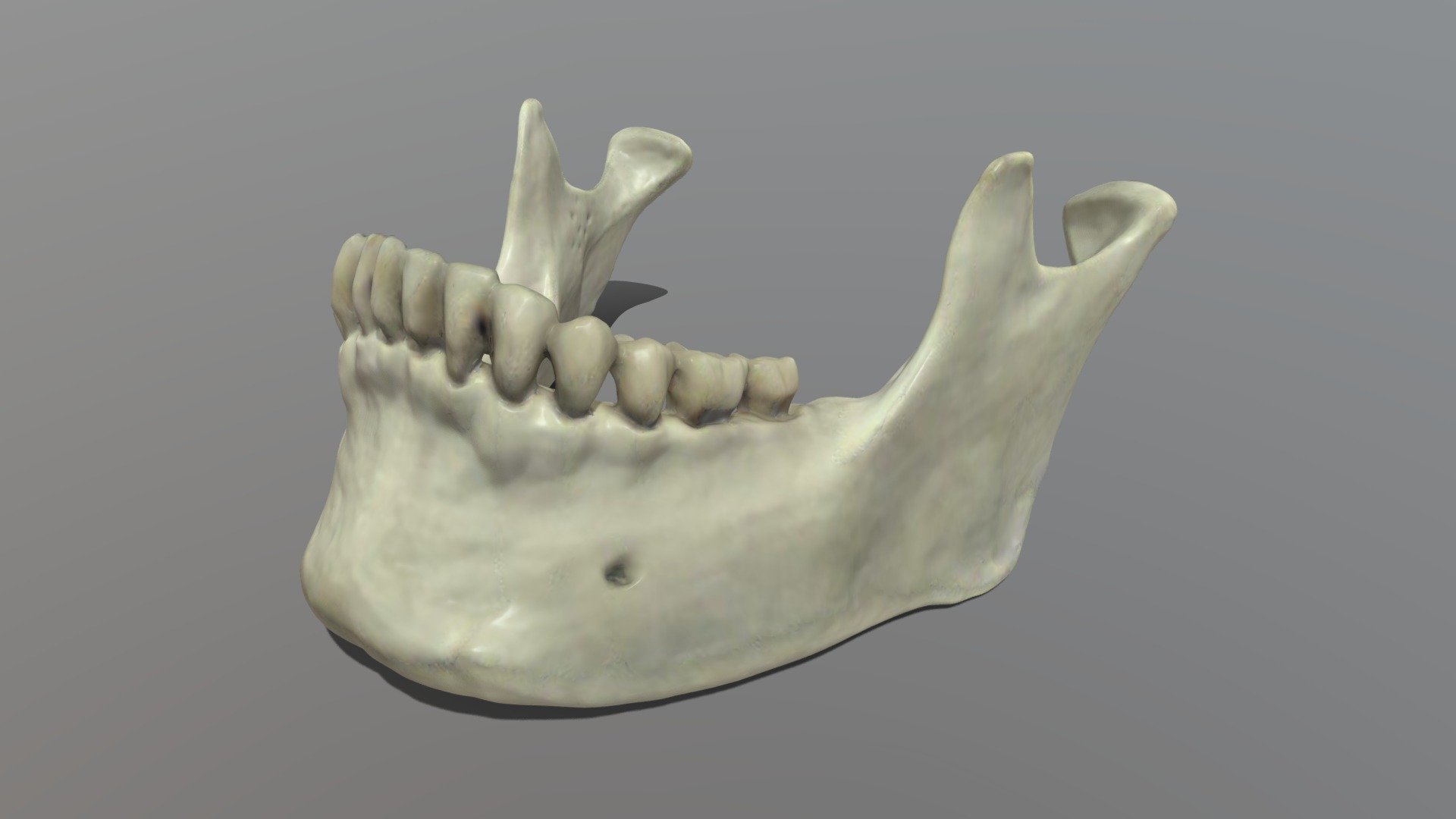 Mandible2 Ennis - 3D model by nennis2026 [307e2de] - Sketchfab