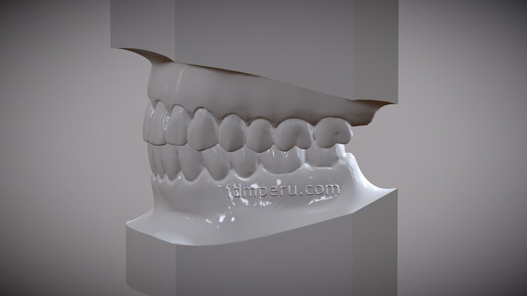 dental - A 3D model collection by Ariace - Sketchfab