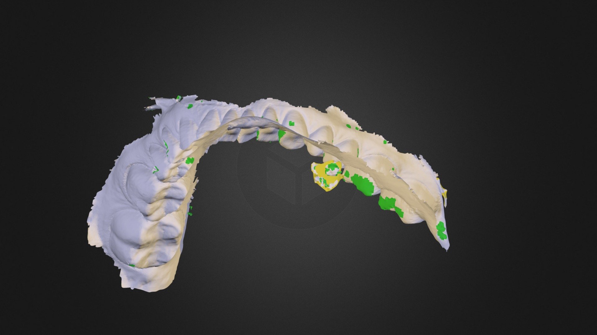 Lower_Arch.stl - 3D model by JayNevin [31207f6] - Sketchfab