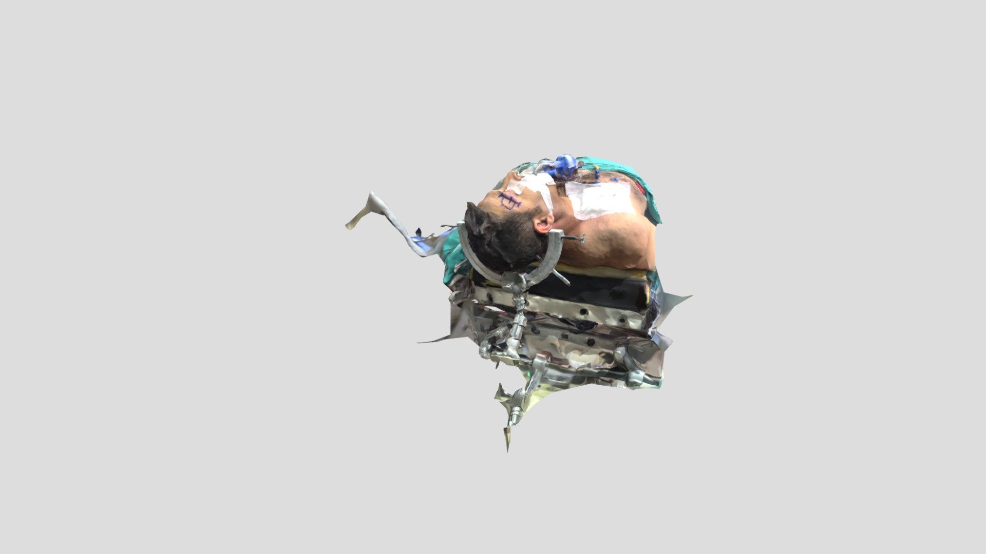 Supraorbital approach with eyebrow incision. - Download Free 3D model ...