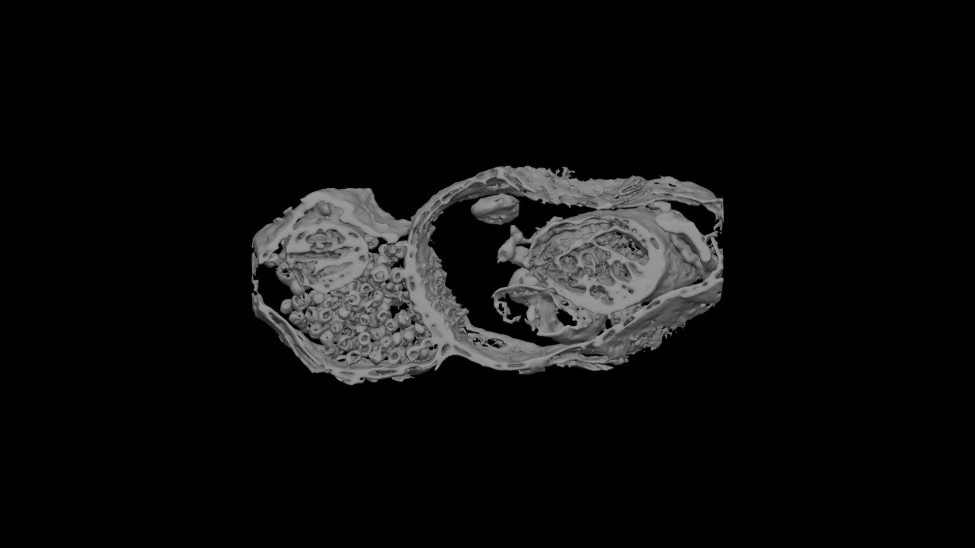 Synapse - EM through 3D SLicer - 3D model by CHEI - UC San Diego (@chei ...