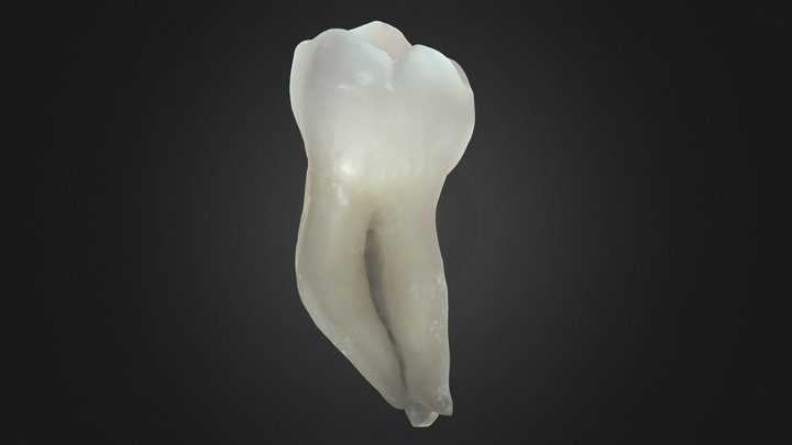 Molar-tooth 3D models - Sketchfab